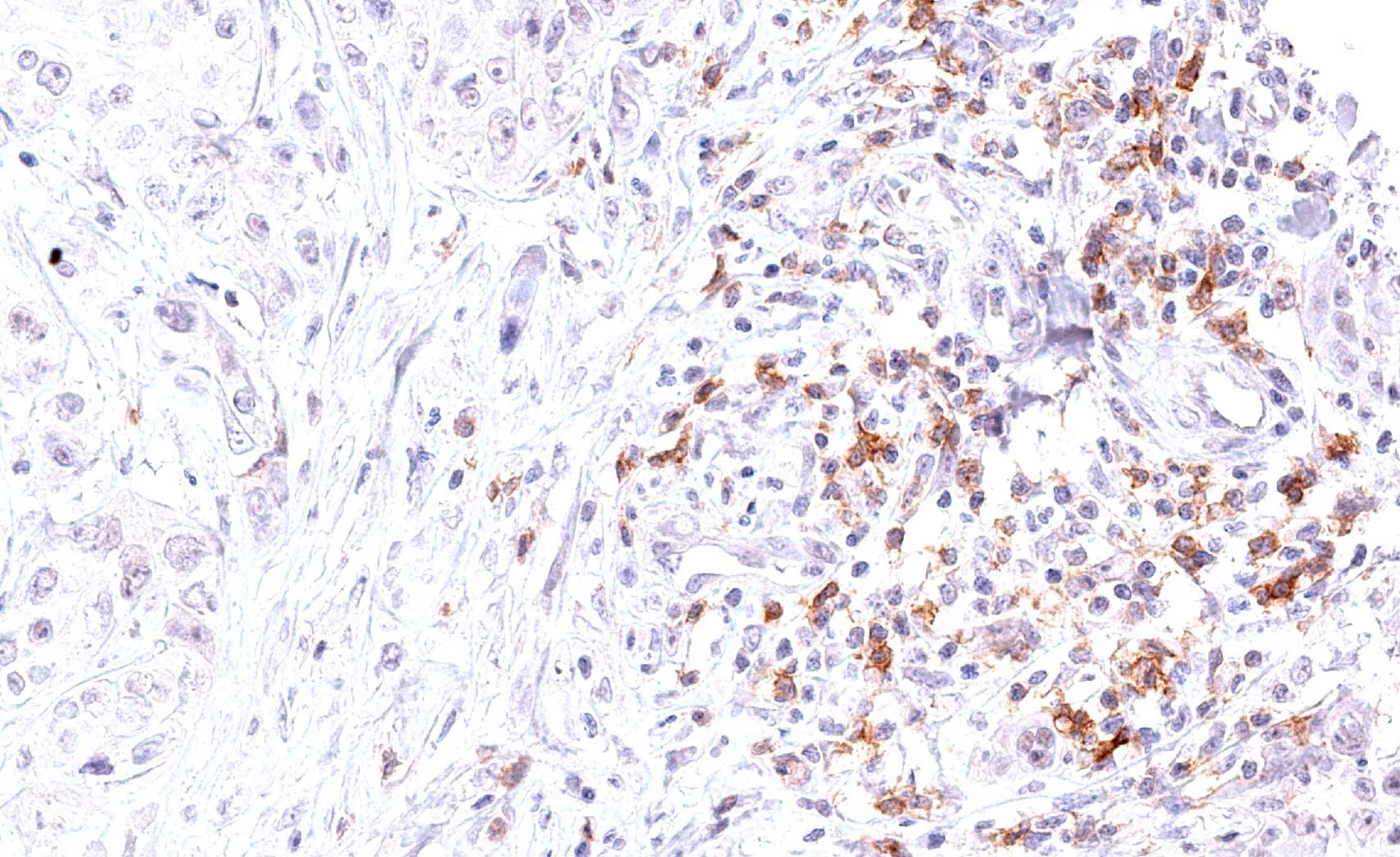 TIGIT antibody (Clone TG1) | ONCOdianova TIGIT anti-human for IHC