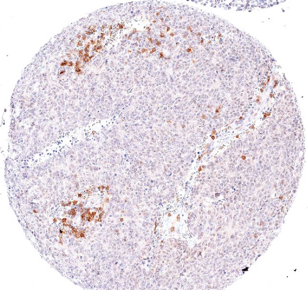 TIGIT antibody (Clone TG1) | ONCOdianova TIGIT anti-human for IHC