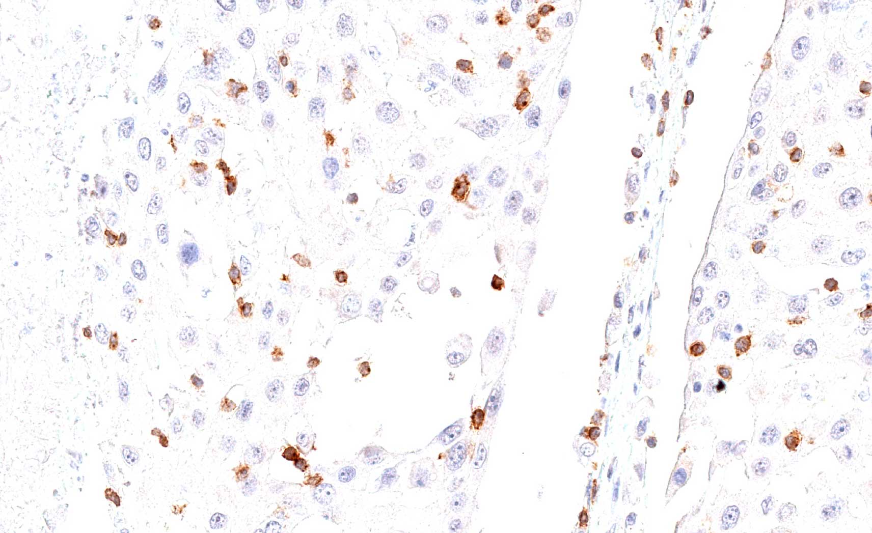 TIGIT antibody (Clone TG1) | ONCOdianova TIGIT anti-human for IHC