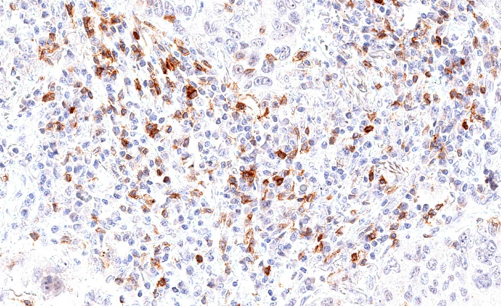 TIGIT antibody (Clone TG1) | ONCOdianova TIGIT anti-human for IHC