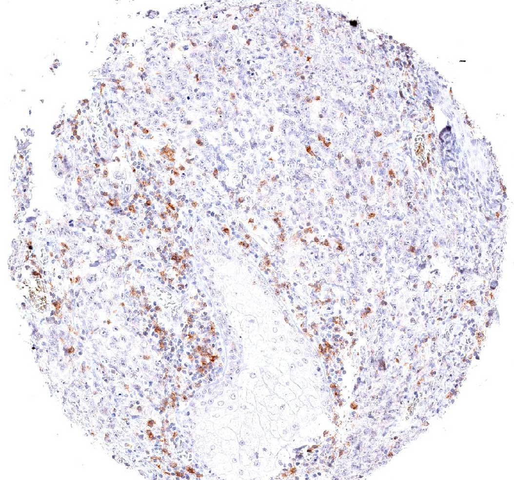 TIGIT antibody (Clone TG1) | ONCOdianova TIGIT anti-human for IHC
