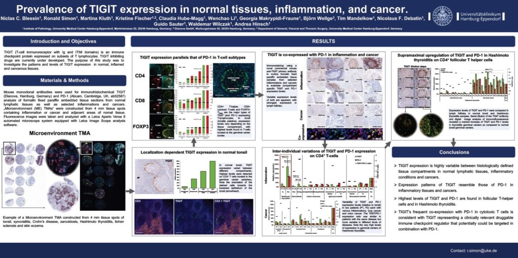 Prevalence of TIGIT expression in normal tissues, inflammation, and ...