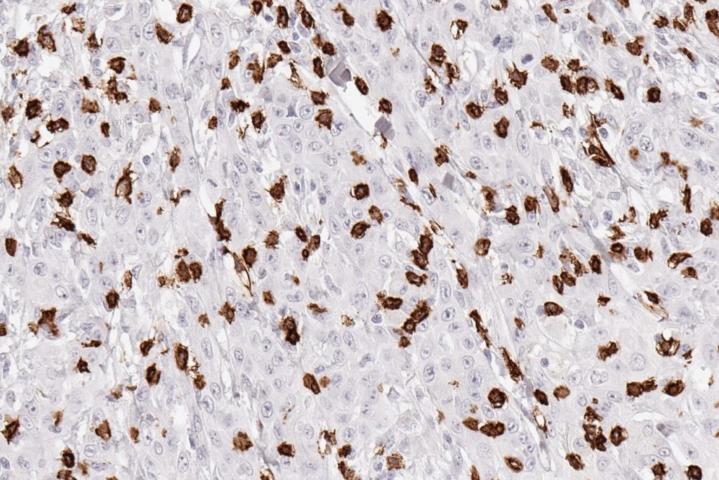 CD8 antibody | ONCOdianova CD8 anti-human (Clone TC8) for IHC CD8 antibody | ONCOdianova CD8 anti-human (Clone TC8) for IHC