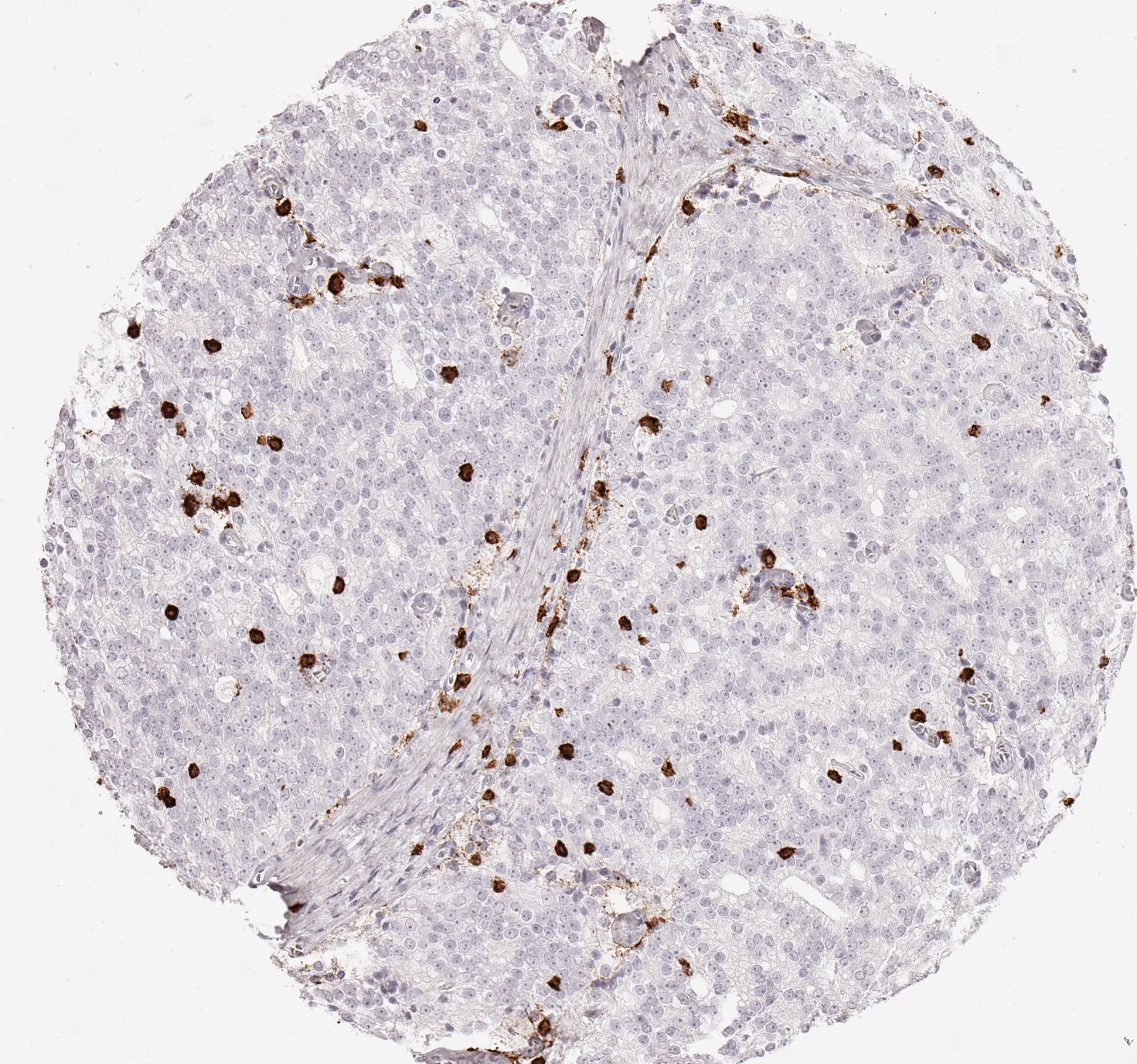 CD8 antibody | ONCOdianova CD8 anti-human for IHC
