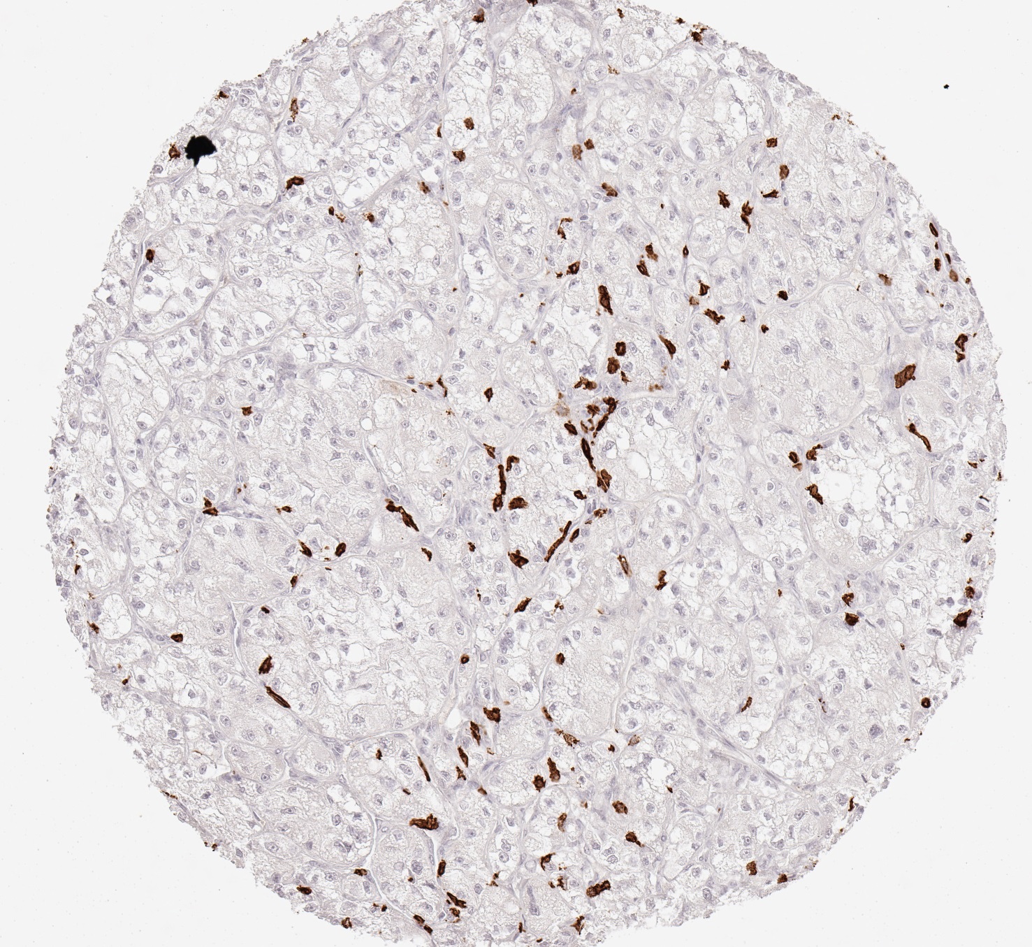CD8 antibody | ONCOdianova CD8 anti-human for IHC