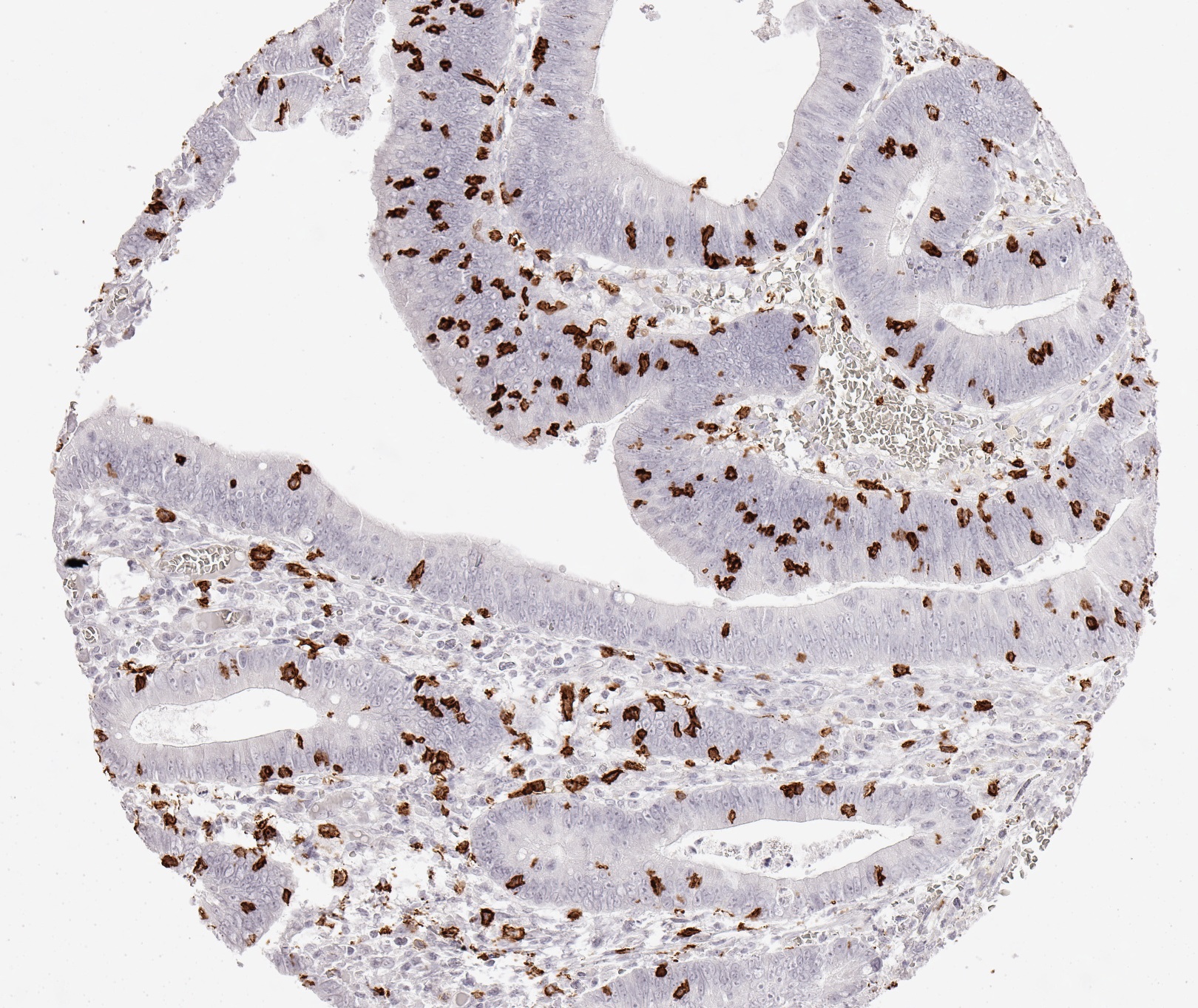 CD8 antibody | ONCOdianova CD8 anti-human for IHC