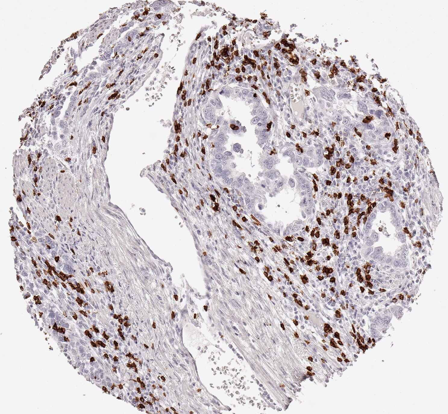 CD8 antibody | ONCOdianova CD8 anti-human for IHC CD8 antibody | ONCOdianova CD8 anti-human for IHC