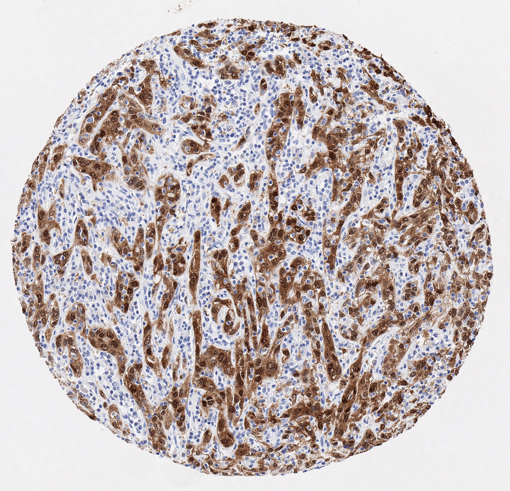p16 antibody | ONCOdianova p16 anti-human antibody for IHC