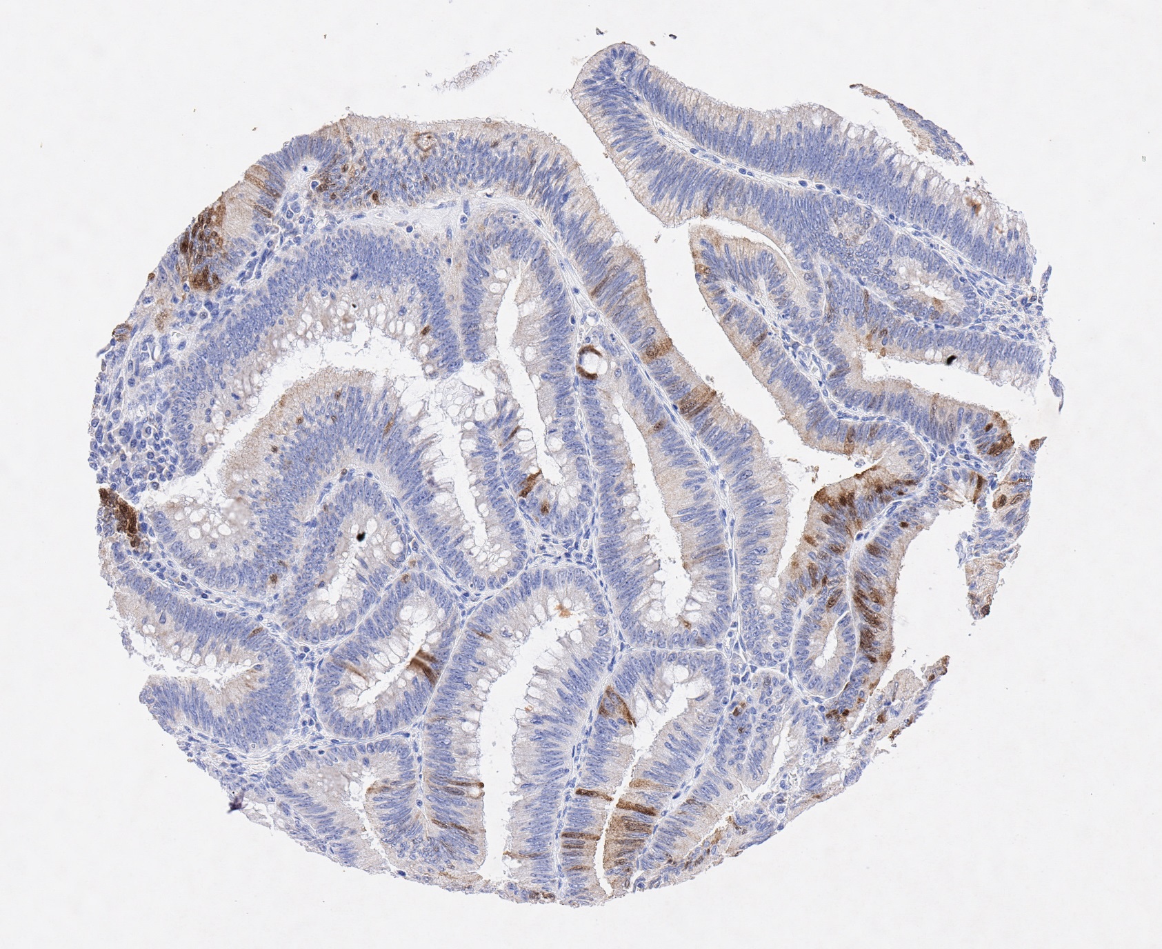 p16 antibody | ONCOdianova p16 anti-human antibody for IHC