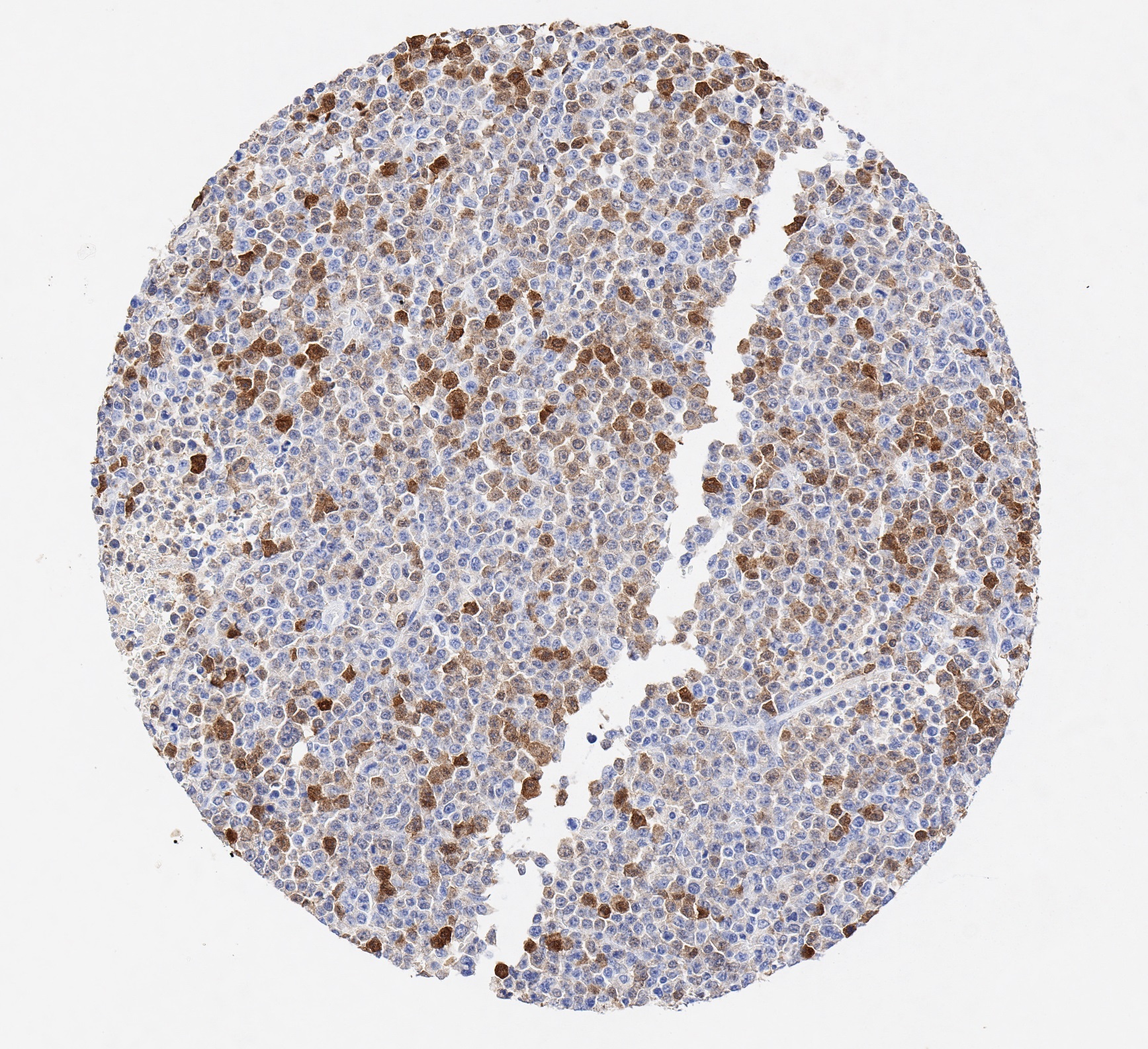 p16 antibody | ONCOdianova p16 anti-human antibody for IHC