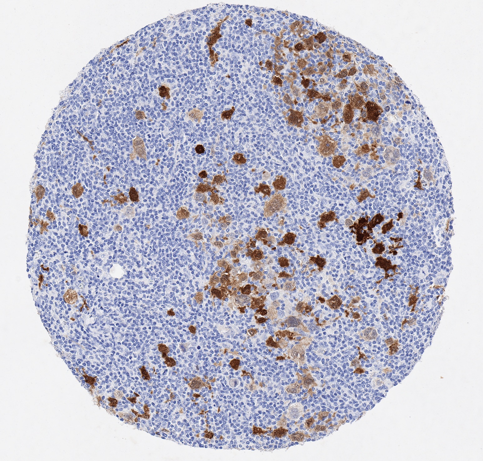 p16 antibody | ONCOdianova p16 anti-human antibody for IHC