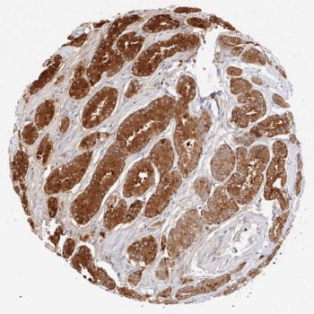 Prostate Specific Antigen (PSA) antibody | ONCOdianova anti-PSA for IHC