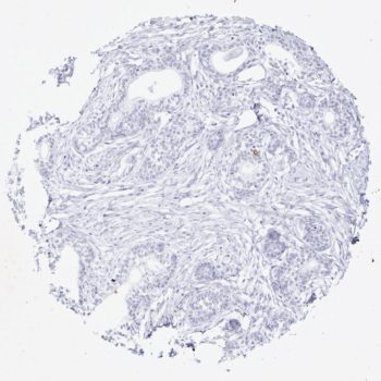 Prostate Specific Antigen (PSA) antibody | ONCOdianova anti-PSA for IHC