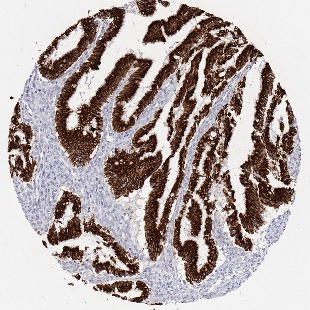 MUC5AC antibody | ONCOdianova anti-human for IHC