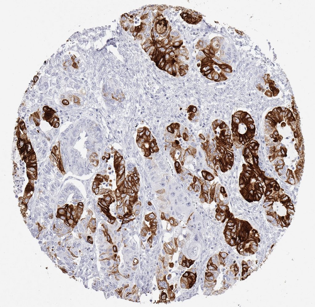 MUC5AC antibody | ONCOdianova anti-human for IHC MUC5AC antibody | ONCOdianova anti-human for IHC