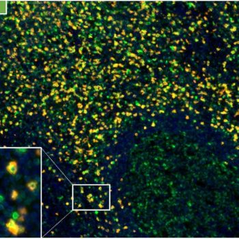 CD112R antibody for multiplex IHC | ONCOdianova