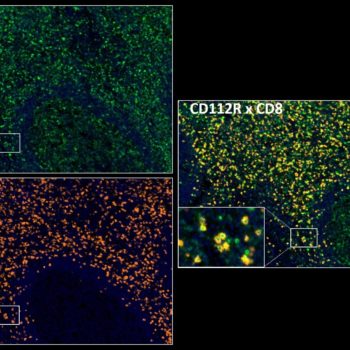 CD112R antibody for multiplex IHC | ONCOdianova