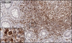 CD112R / PVRIG anti-human | ONCOdianova CD112R antibody (IHC)
