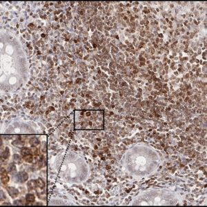 CD112R antibody for multiplex IHC | ONCOdianova