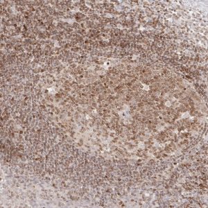 CD112R antibody for multiplex IHC | ONCOdianova