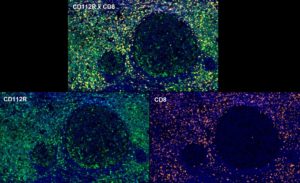 CD112R / PVRIG anti-human | ONCOdianova CD112R antibody (IHC)
