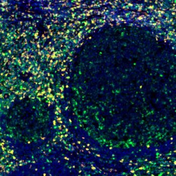 CD112R antibody for multiplex IHC | ONCOdianova